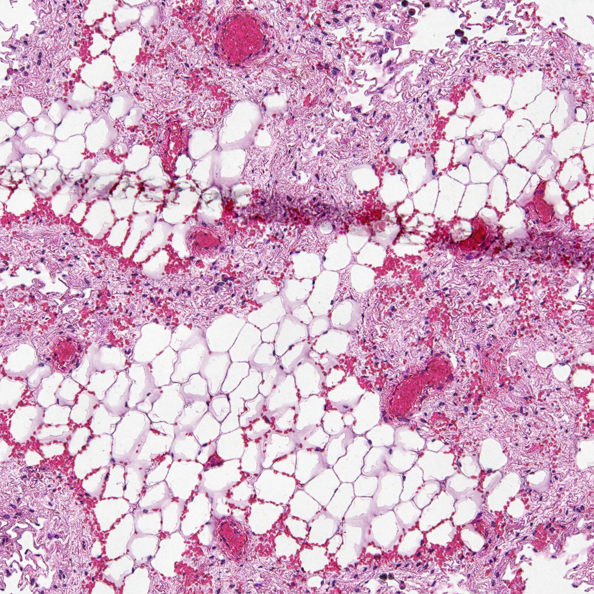 MIRA vision - The Future of Medical Diagnostics